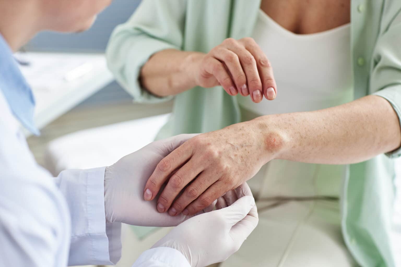 Kava Dermopathy: Causes, Symptoms and solutions - Fiji Vanua Kava